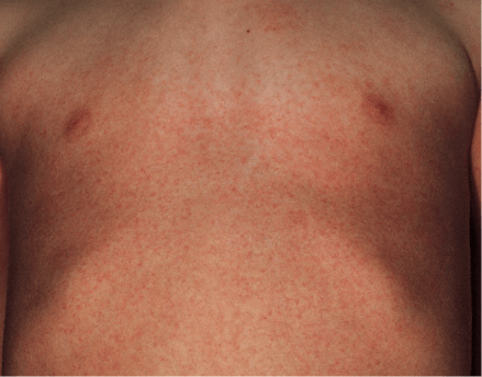 April | 2016 | PAINE Podcast and Medical Blog