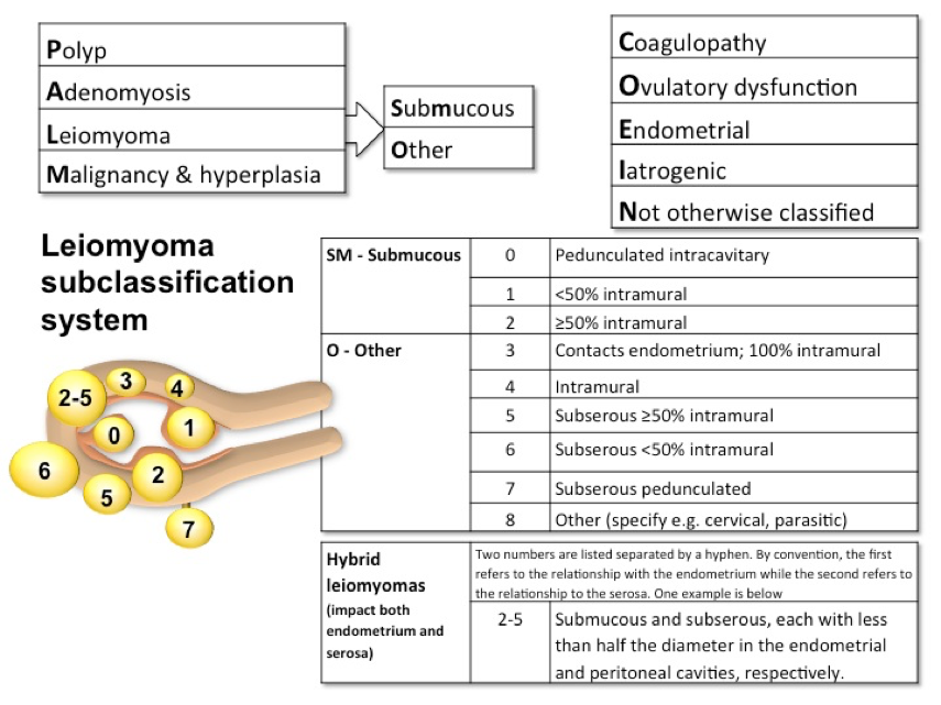 #27 – Abnormal Uterine Bleeding – Definitions and Classifications ...