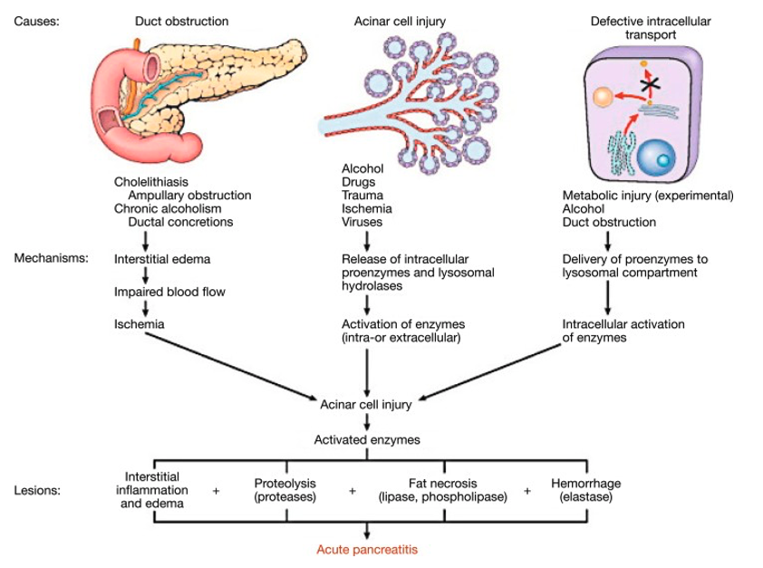 #65 – Pancreatitis | PAINE Podcast and Medical Blog